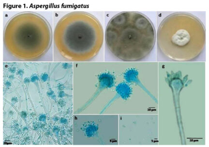 Composting And Aspergillus Fumigatus — A Re-Emergent Issue? | BioCycle